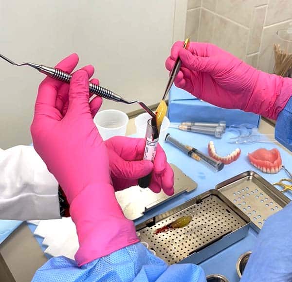 What Is L-PRF? | Oral Surgery in Foley, AL